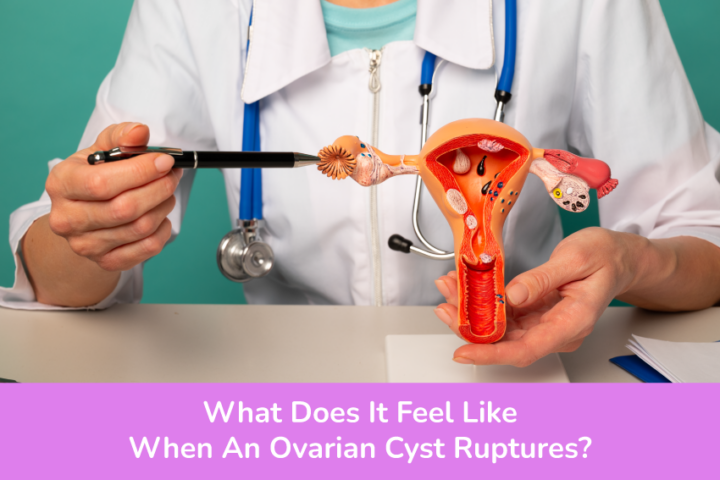 What Does It Feel Like When An Ovarian Cyst Ruptures?